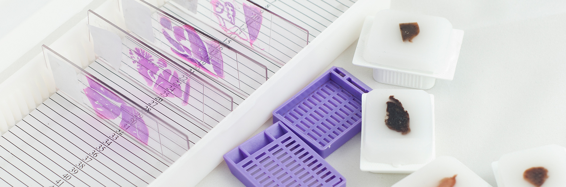 Histology Lab Supplies | General Data Company, Inc.